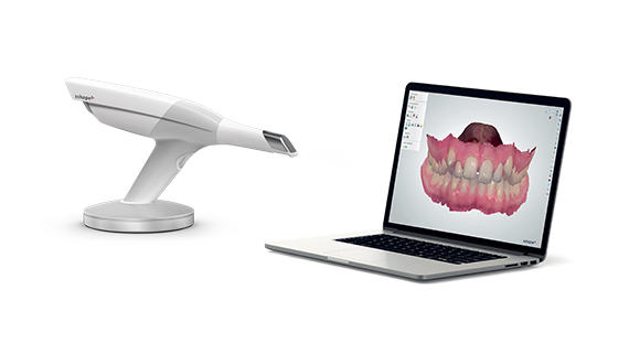 Different types of Intraoral scanners - London Orthodontics